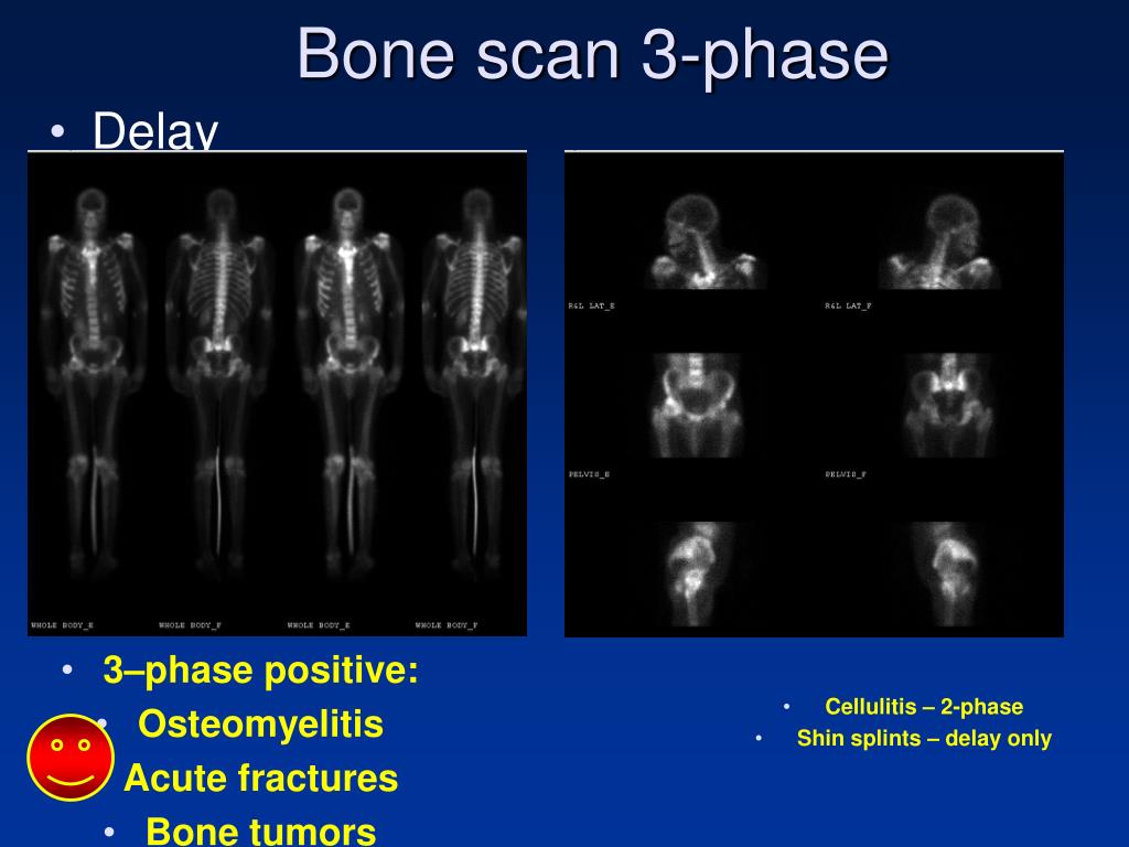 PPT - NUCLEAR MEDICINE & POSITRON EMISSION TOMOGRAPHY PowerPoint ...