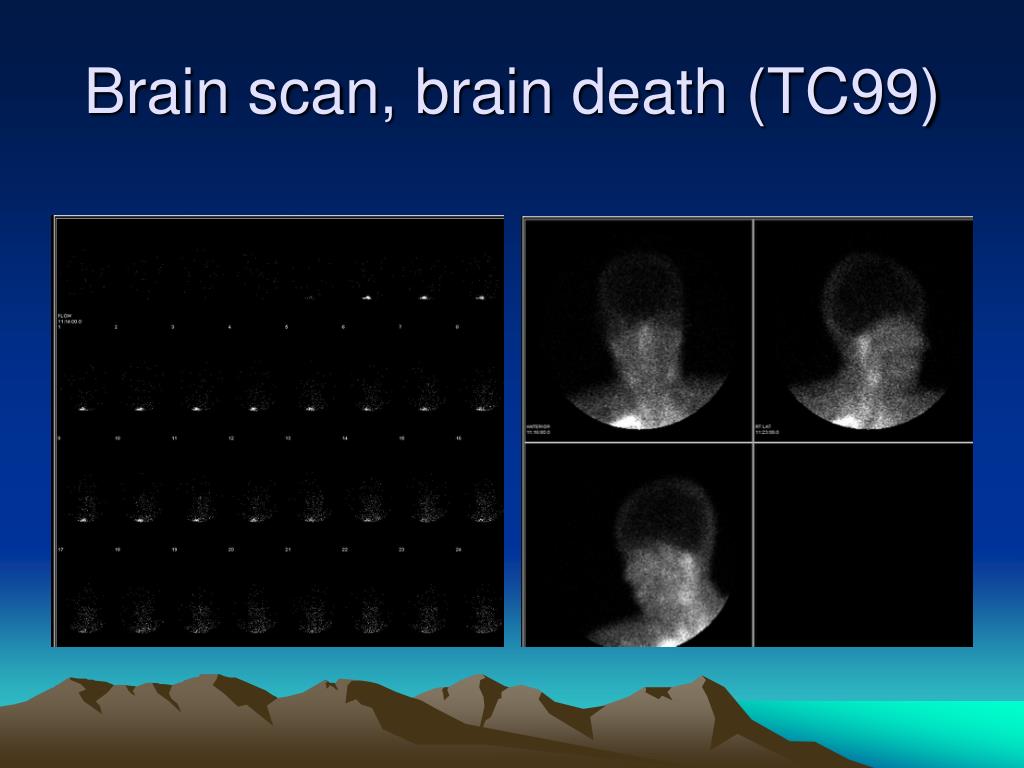 PPT - NUCLEAR MEDICINE & POSITRON EMISSION TOMOGRAPHY PowerPoint ...