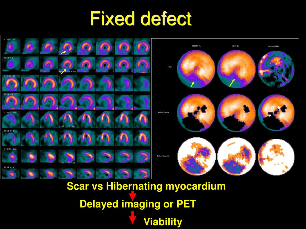 PPT - NUCLEAR MEDICINE & POSITRON EMISSION TOMOGRAPHY PowerPoint ...