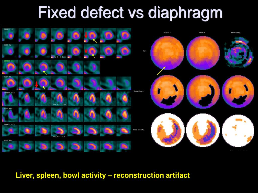 PPT - NUCLEAR MEDICINE & POSITRON EMISSION TOMOGRAPHY PowerPoint ...