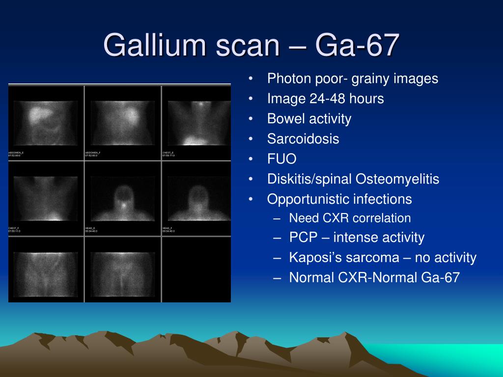 PPT - NUCLEAR MEDICINE & POSITRON EMISSION TOMOGRAPHY PowerPoint ...