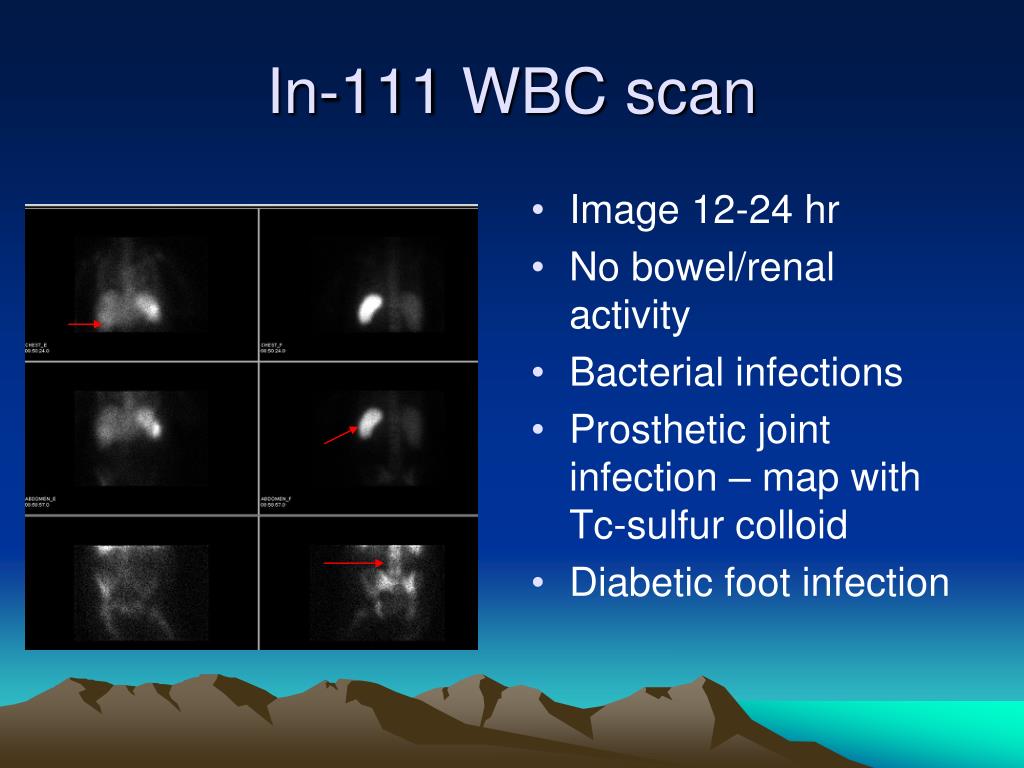 PPT - NUCLEAR MEDICINE & POSITRON EMISSION TOMOGRAPHY PowerPoint ...