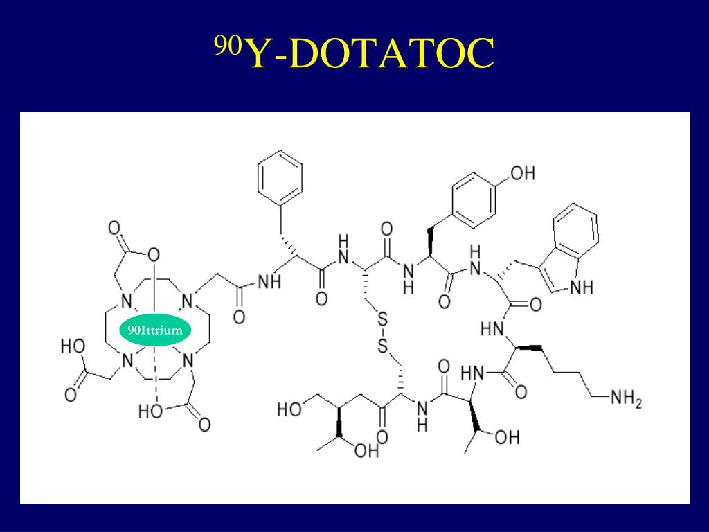 PPT - Neoplasie della tiroide Carcinoma scarsamente differenziato ...
