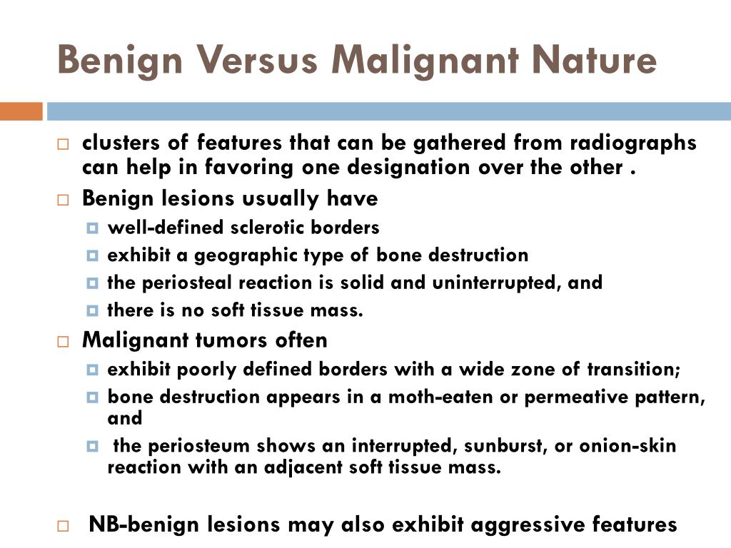 PPT - Primary bone tumors presenter: ondari n.j FACILITATOr : prof ...