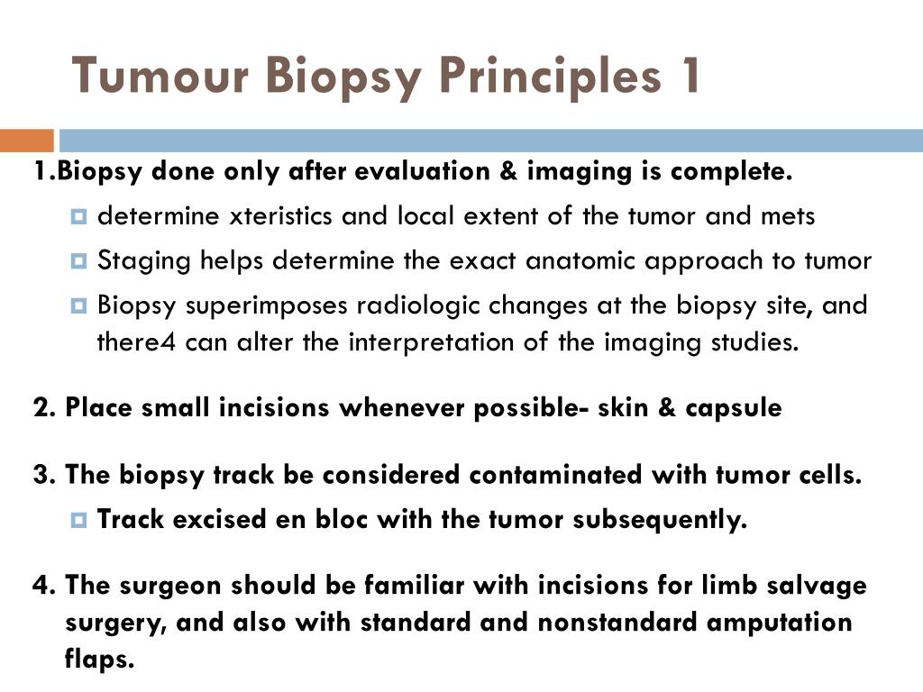 PPT - Primary bone tumors presenter: ondari n.j FACILITATOr : prof . gakuu PowerPoint ...