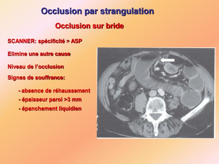 PPT - DOULEUR ABDOMINALE PowerPoint Presentation - ID:3304160