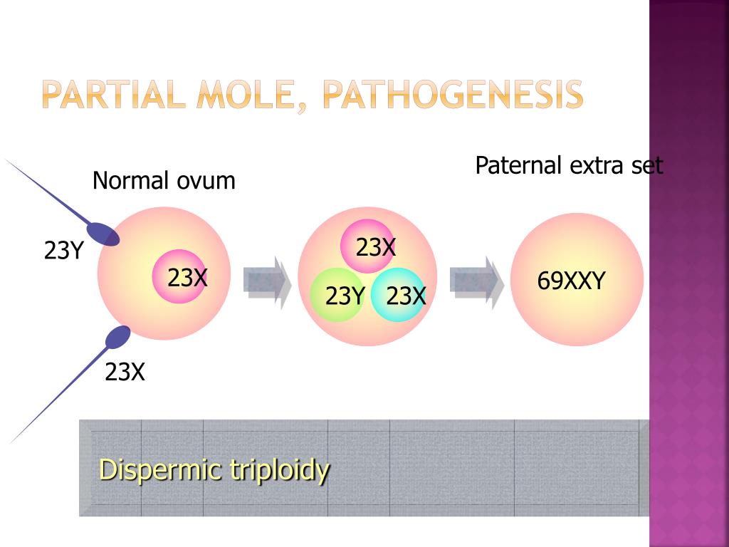 PPT - Gestational trophoblastic disease dr.maryam bakir fibogo-dgo ...