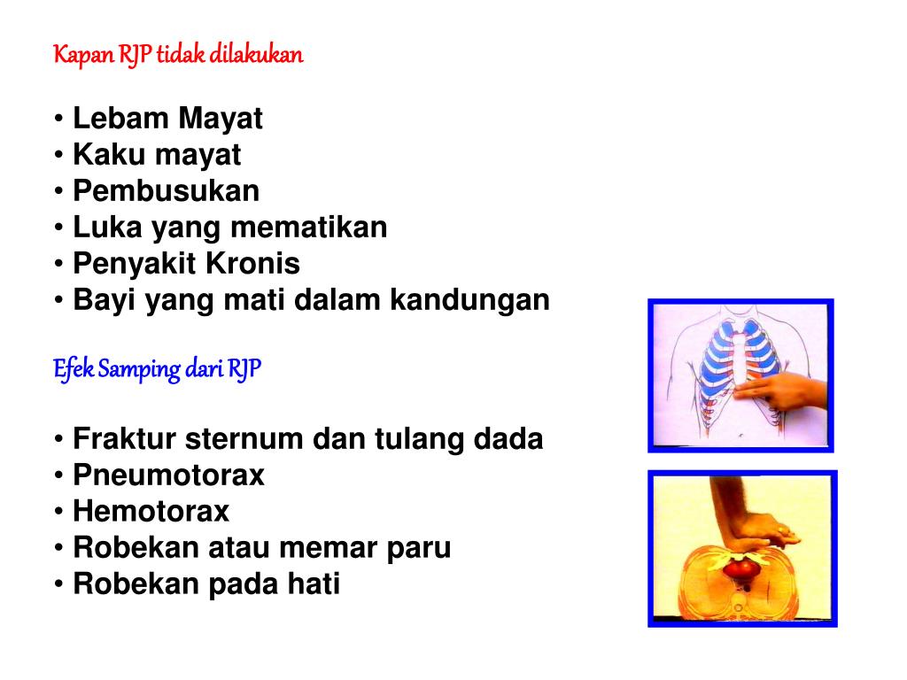 PPT - BANTUAN HIDUP DASAR DAN RESUSITASI JANTUNG PARU ( RJP ...