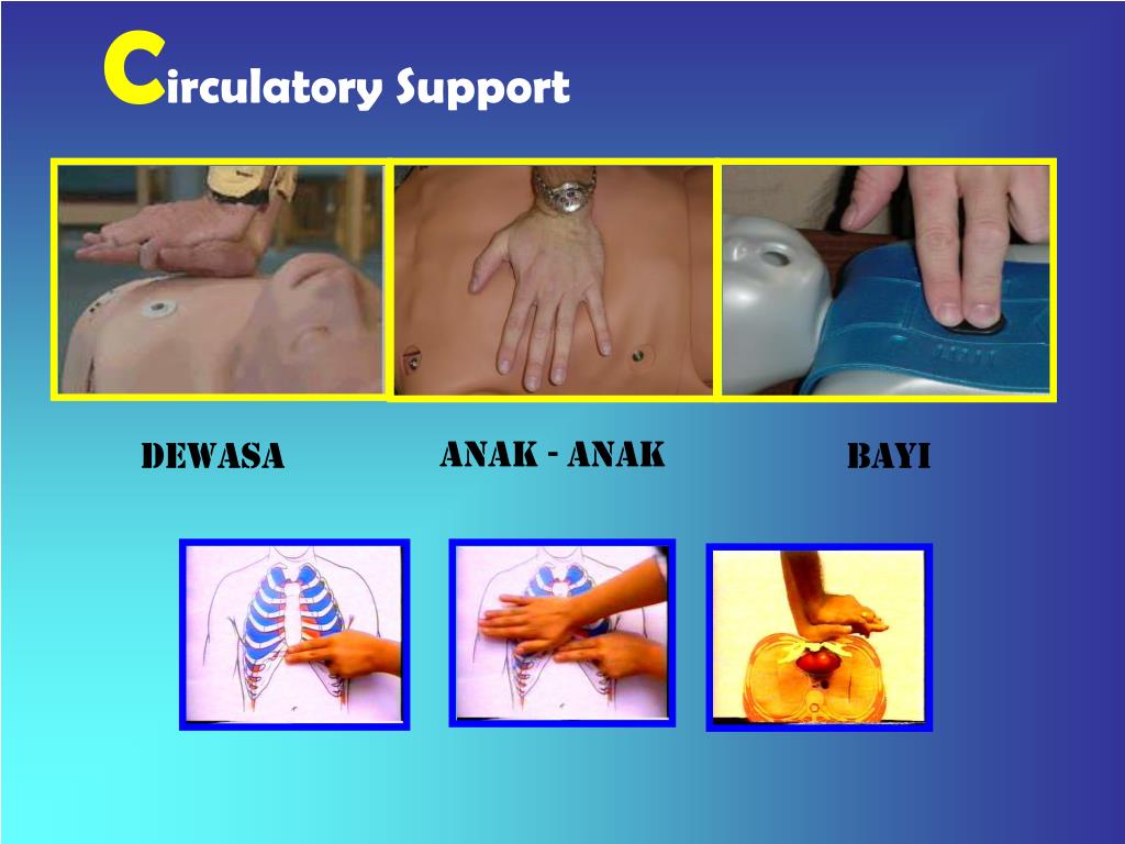 PPT - BANTUAN HIDUP DASAR DAN RESUSITASI JANTUNG PARU ( RJP ...