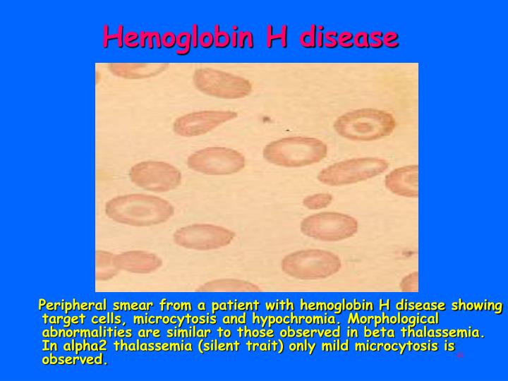 PPT - Hemoglobinopathies PowerPoint Presentation - ID:3308126
