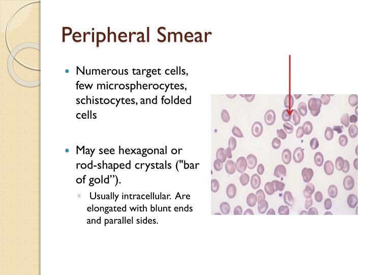 PPT - MLAB 1415:Hematology Keri Brophy -Martinez PowerPoint ...