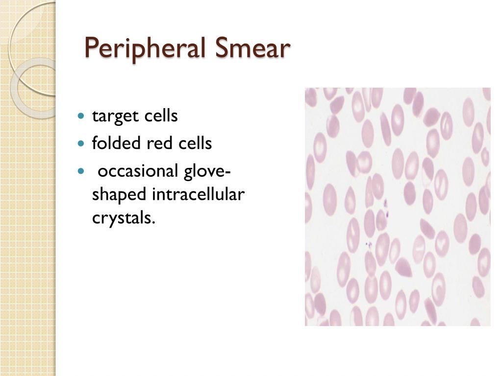 PPT - MLAB 1415:Hematology Keri Brophy -Martinez PowerPoint ...