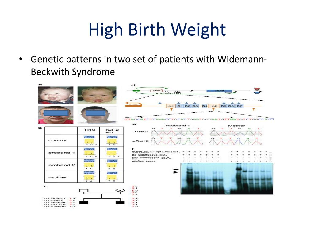 PPT - Epidemiology of high birth weight (HBW) PowerPoint Presentation ...