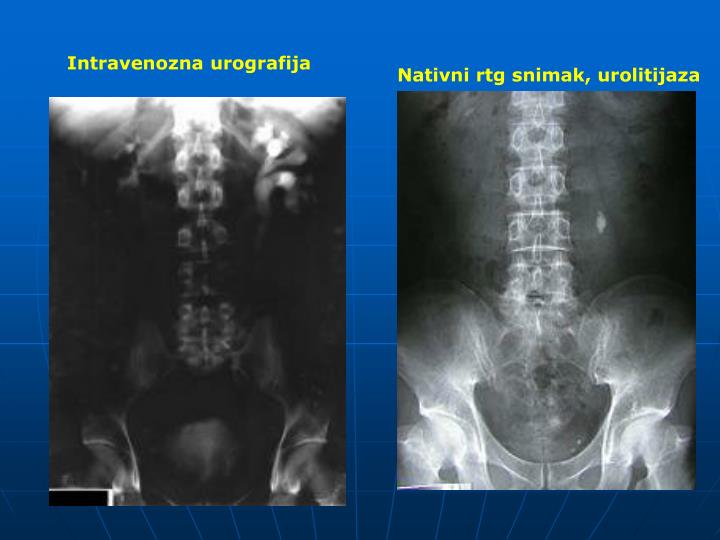 PPT - NEFROLOGIJA PowerPoint Presentation - ID:3308530