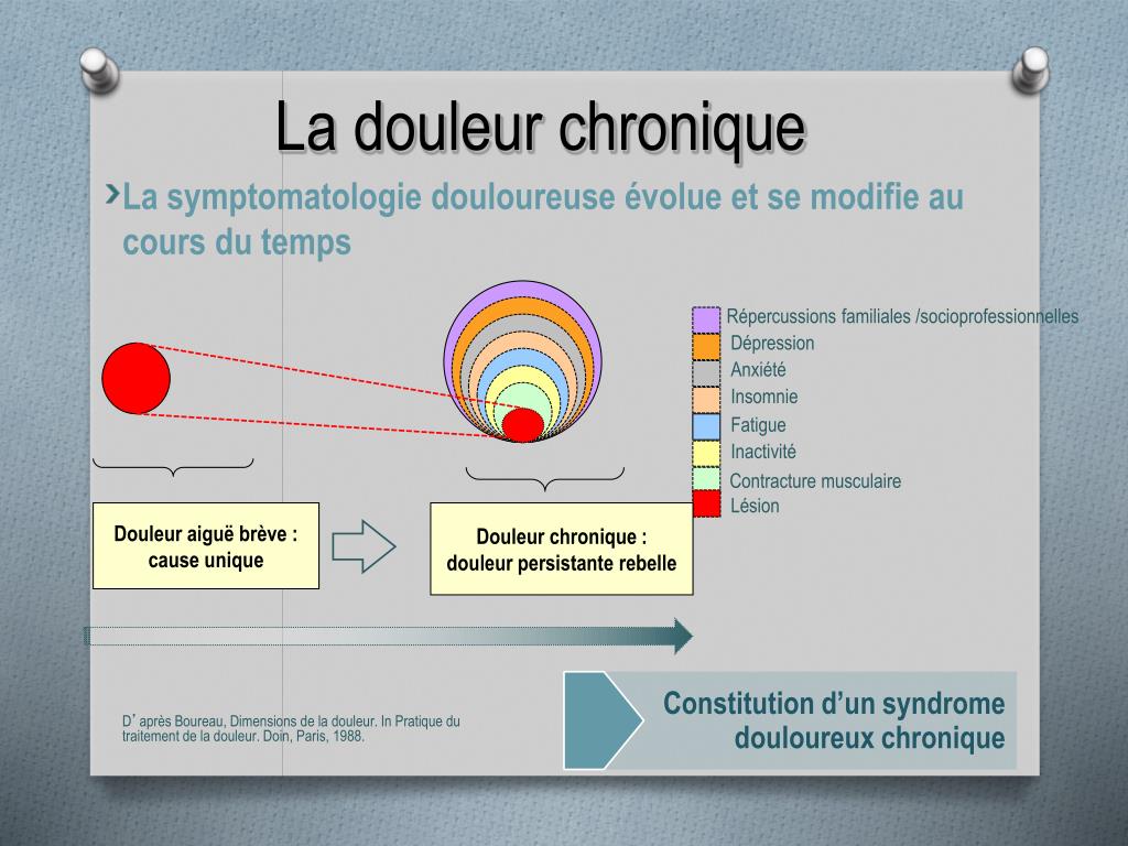 PPT - La consultation de la douleur Aujourd ’ hui PowerPoint ...
