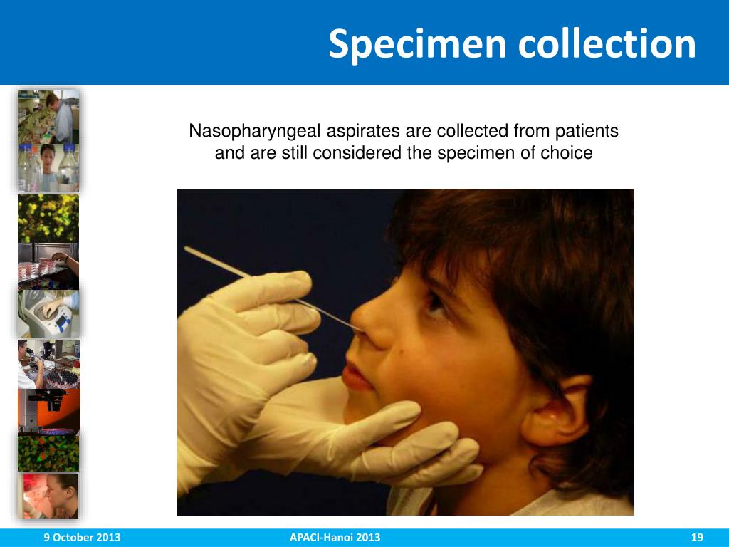 PPT - Diagnosis and Management of Influenza PowerPoint Presentation ...