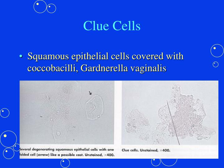 PPT - Microscopic Urinalysis PowerPoint Presentation - ID:3311650