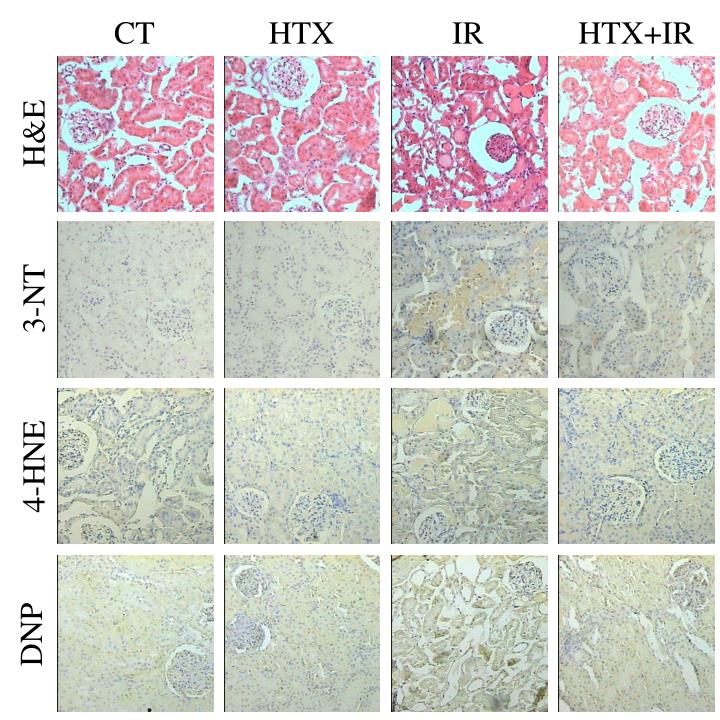 PPT - HTX PowerPoint Presentation, free download - ID:3311813