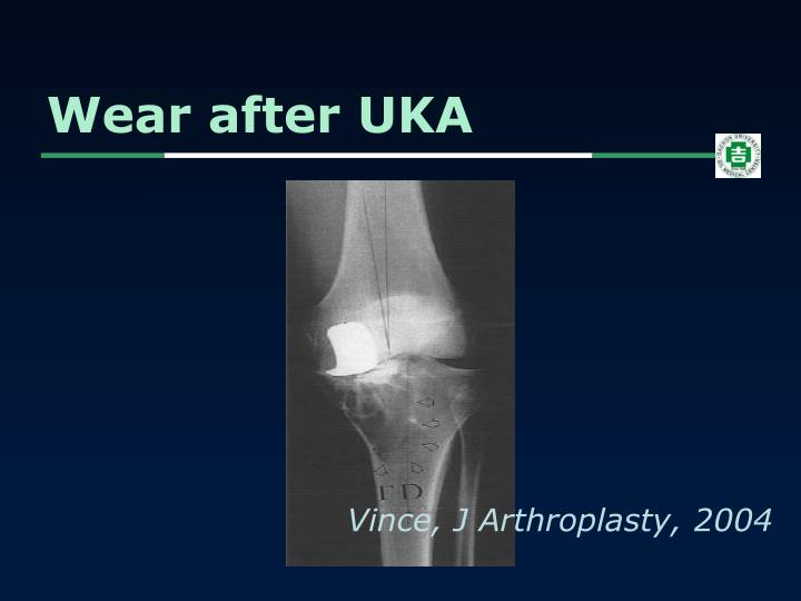 PPT - Operation of Arthritic Knee - HTO vs UKA - PowerPoint ...