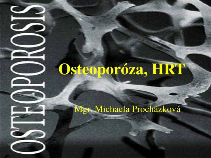 PPT - Osteoporóza, HRT PowerPoint Presentation, free download - ID:3311907