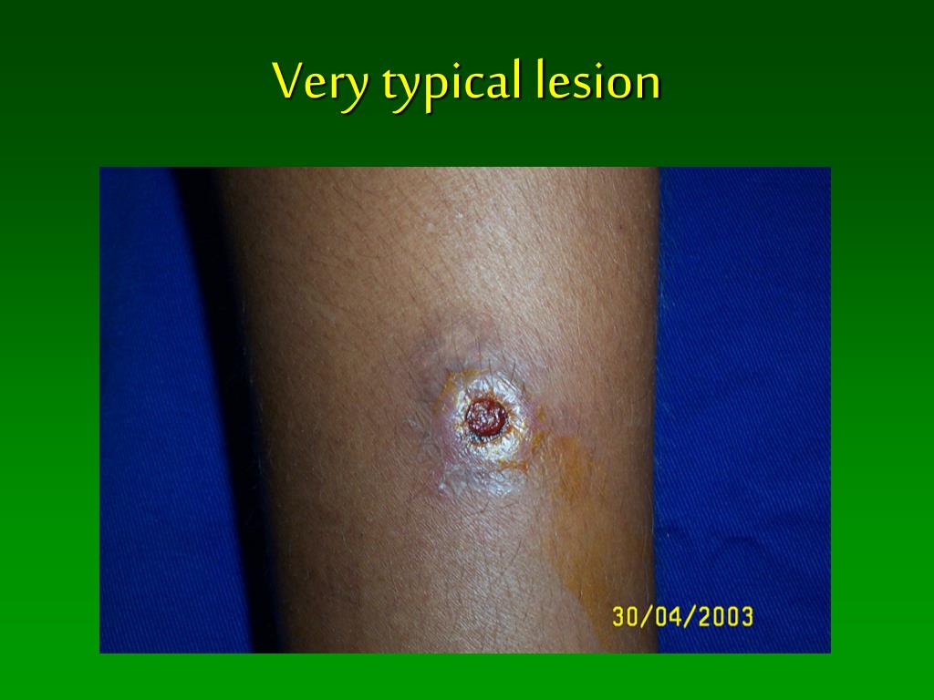 PPT - Plague, pests and parasites: living it up in Brazil PowerPoint ...