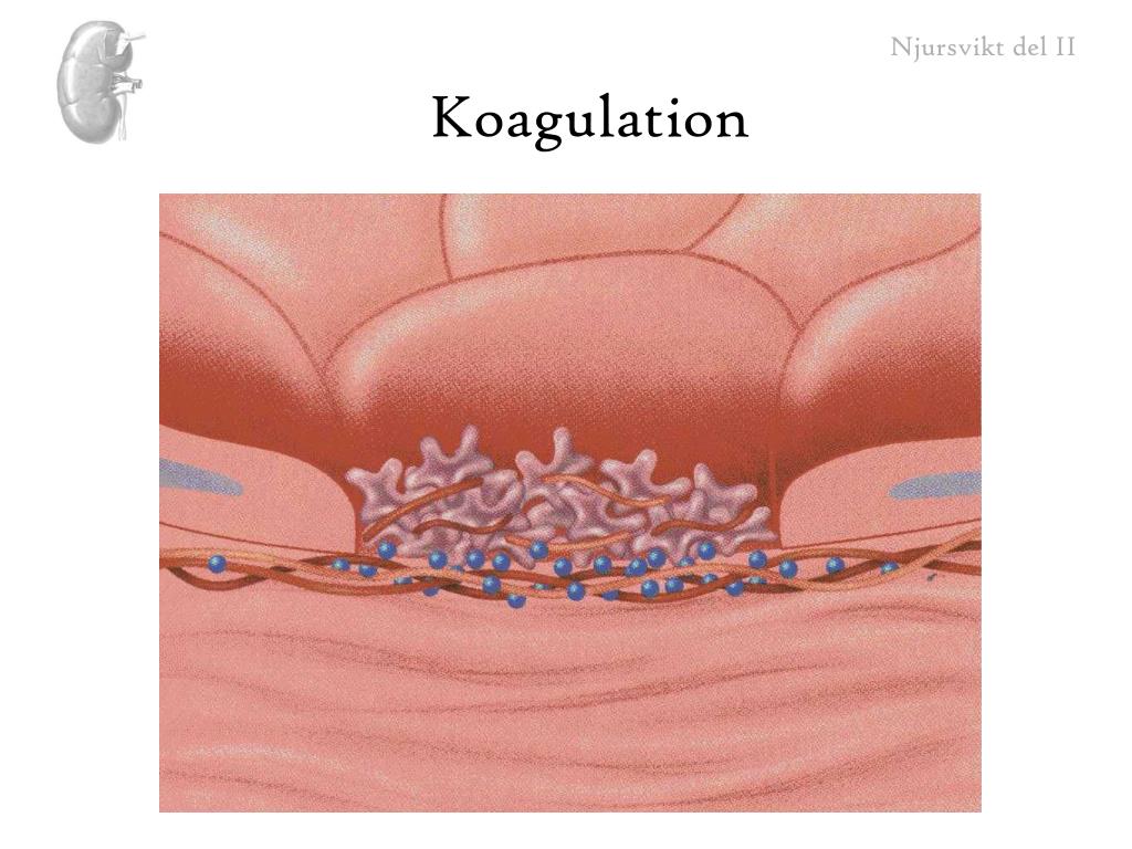 PPT - Njurfysiologi och behandling av njursvikt PowerPoint Presentation ...