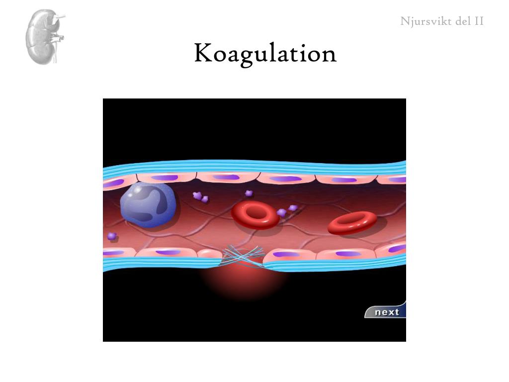 PPT - Njurfysiologi och behandling av njursvikt PowerPoint Presentation ...