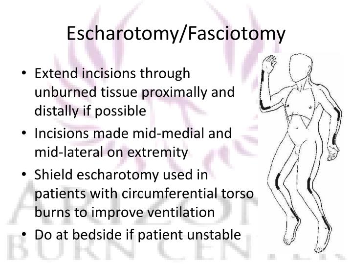 PPT - Burns in the Emergency Department PowerPoint Presentation - ID ...