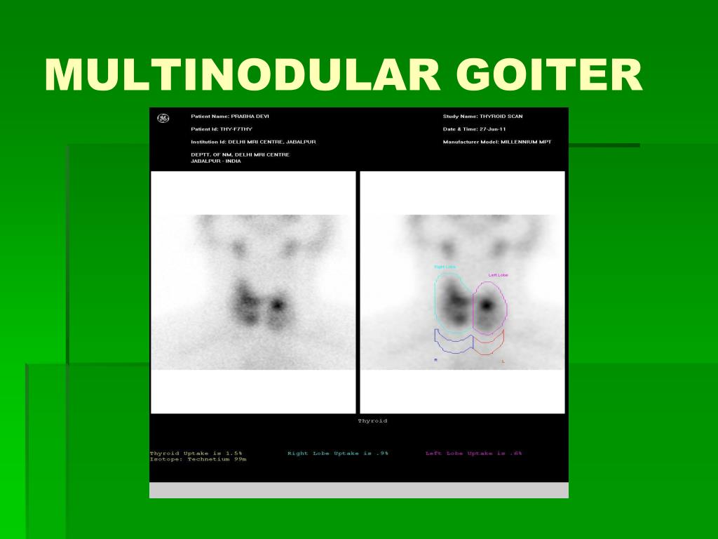 PPT - DELHI MRI CENTRE JABALPUR PowerPoint Presentation, free download ...