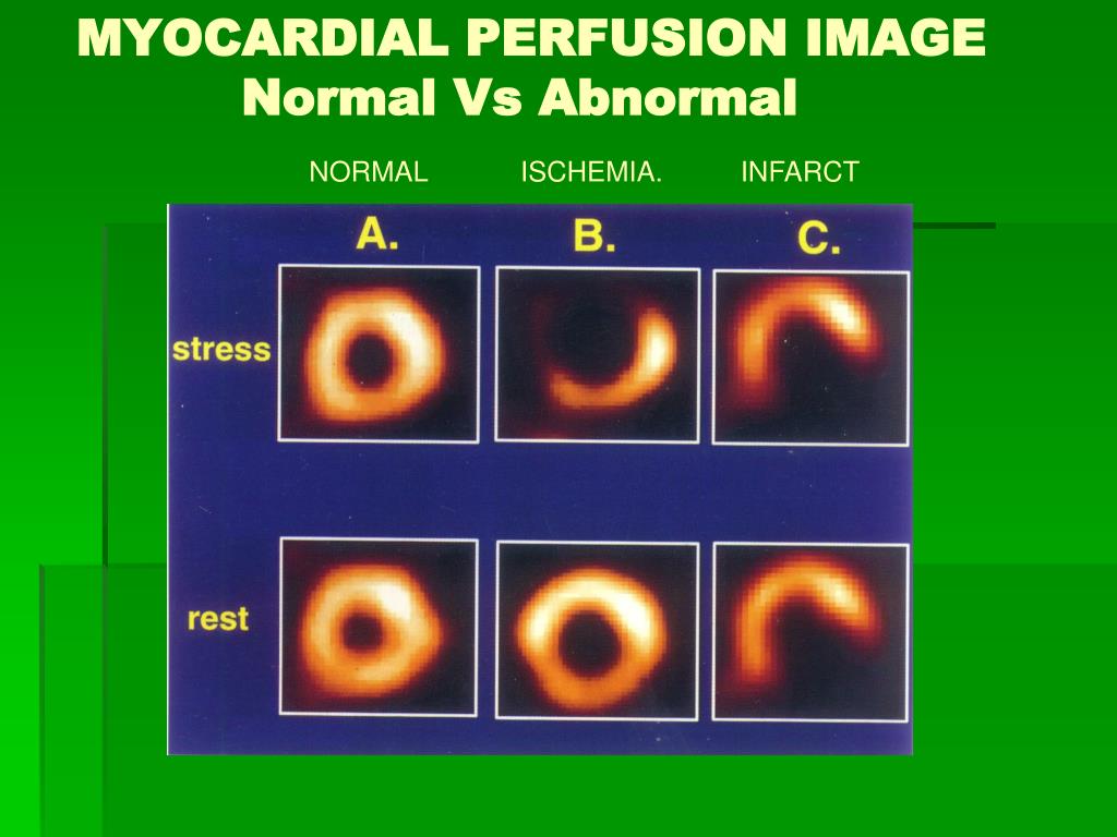 PPT - DELHI MRI CENTRE JABALPUR PowerPoint Presentation, free download ...