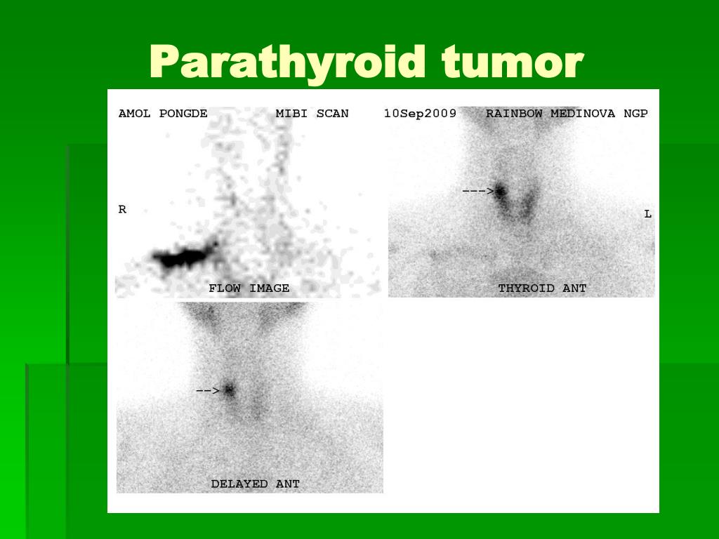 PPT - DELHI MRI CENTRE JABALPUR PowerPoint Presentation, free download ...