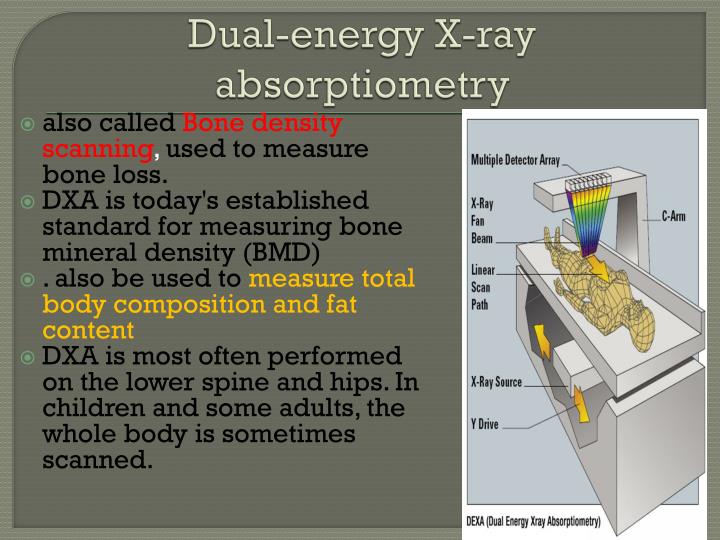 PPT - PROTEIN ENERGY MALNUTRITION PowerPoint Presentation - ID:3314952
