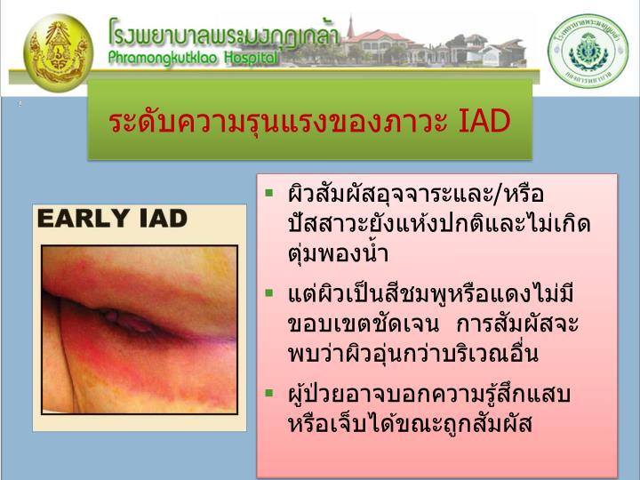PPT - Incontinence-Associated Dermatitis ( IAD ) PowerPoint ...