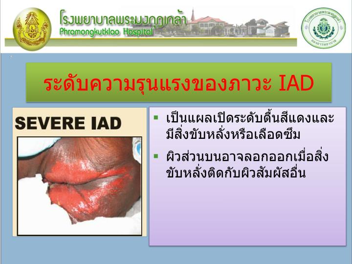 PPT - Incontinence-Associated Dermatitis ( IAD ) PowerPoint ...