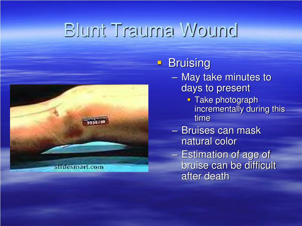 PPT - Medico-Legal Investigations PowerPoint Presentation, free ...