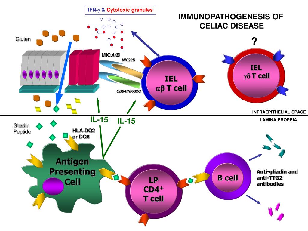 PPT - The Role of TCR gamma-delta T cells in Celiac Disease PowerPoint ...