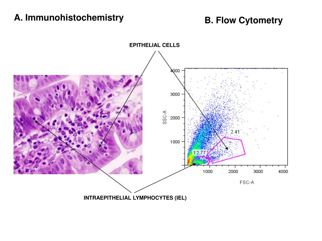 PPT - The Role of TCR gamma-delta T cells in Celiac Disease PowerPoint ...