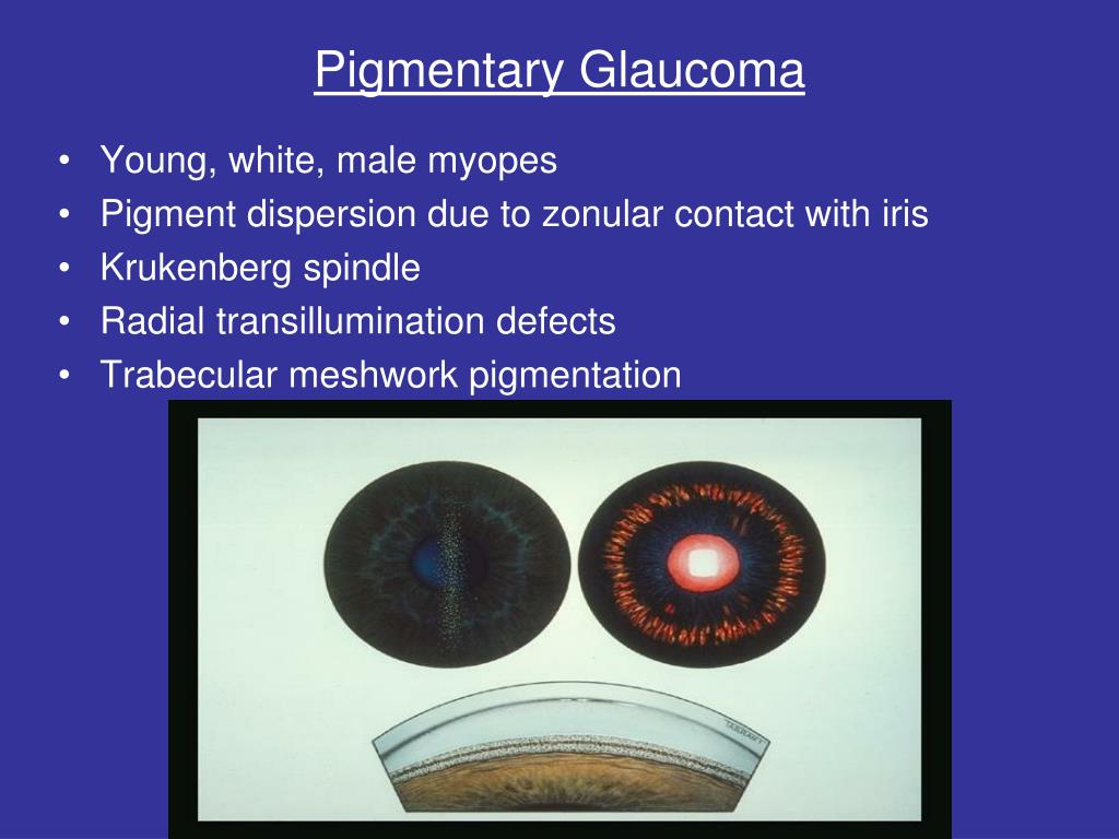 PPT - DR.K.SUDHAMATHI CONSULTANT EYEQ SUPERSPECIALITY HOSPITALS ...