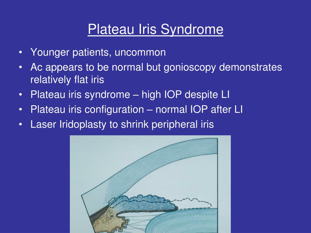 PPT - DR.K.SUDHAMATHI CONSULTANT EYEQ SUPERSPECIALITY HOSPITALS ...