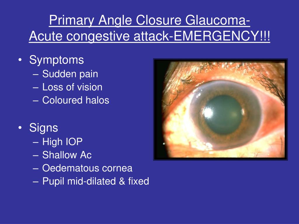 PPT - DR.K.SUDHAMATHI CONSULTANT EYEQ SUPERSPECIALITY HOSPITALS ...