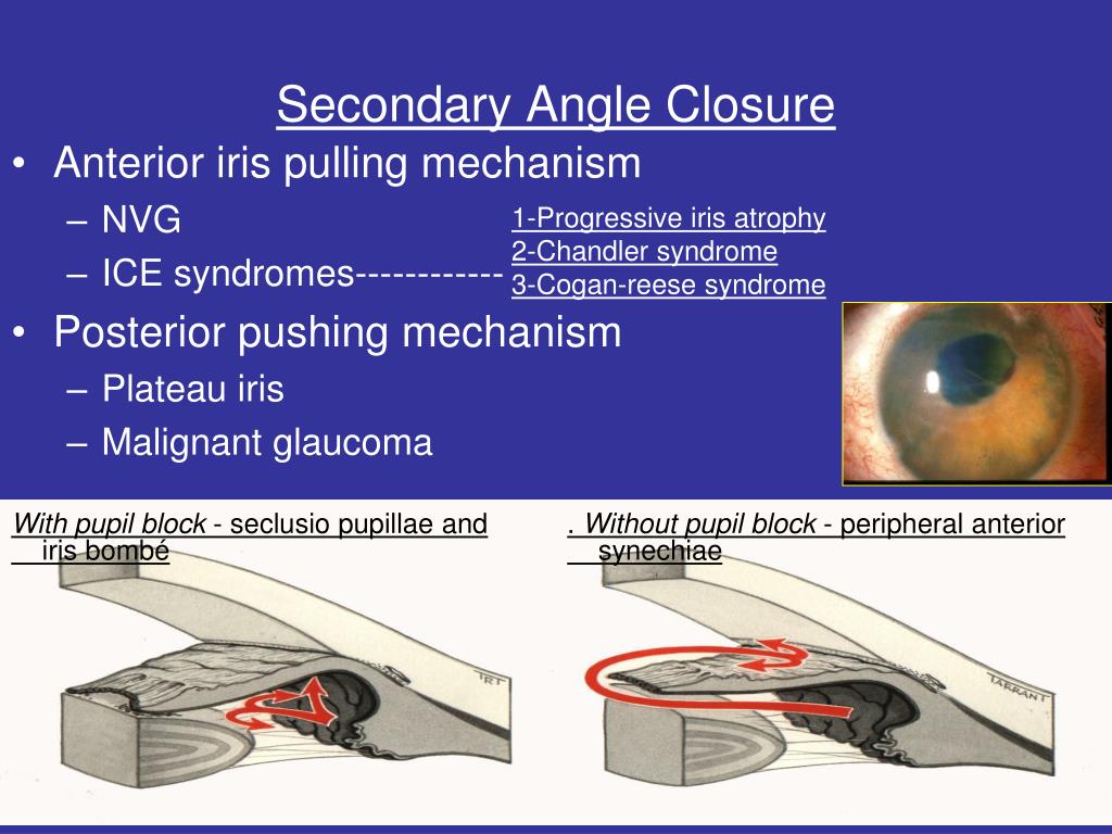 PPT - DR.K.SUDHAMATHI CONSULTANT EYEQ SUPERSPECIALITY HOSPITALS ...