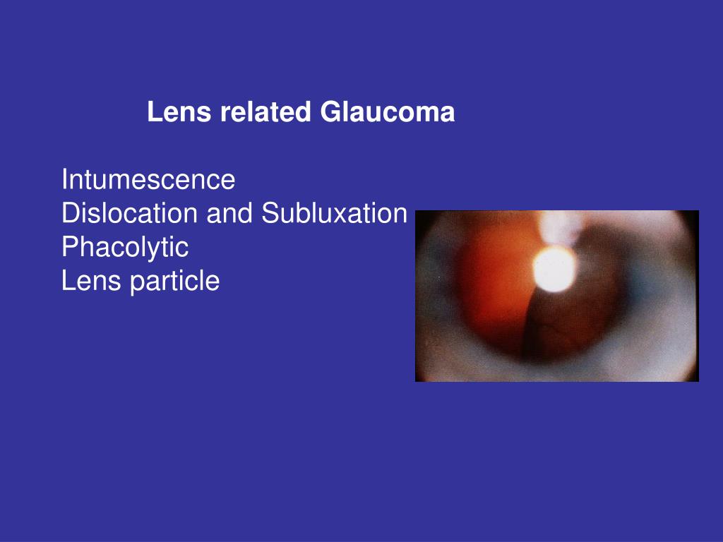 PPT - DR.K.SUDHAMATHI CONSULTANT EYEQ SUPERSPECIALITY HOSPITALS ...