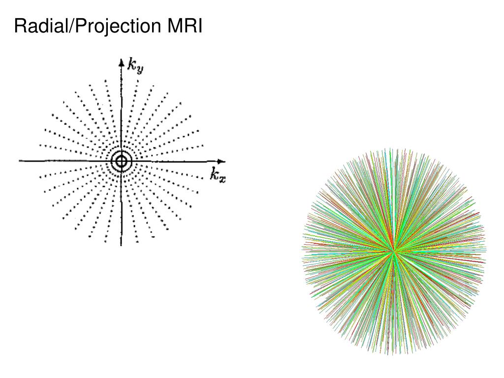 PPT - RSL/MRSL Journal Club 8.27.2010 VIPR/Radial MRI Kitty Moran ...