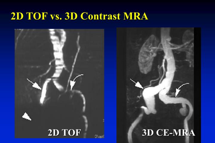 PPT - University of Wisconsin MRI PowerPoint Presentation - ID:3321834