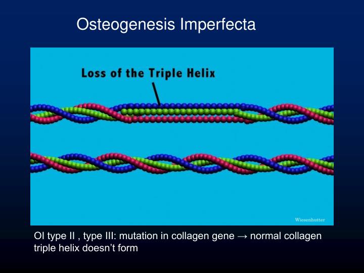 PPT - Genetic Collagen Disorders Osteogenesis Imperfecta Ehlers Danlos ...