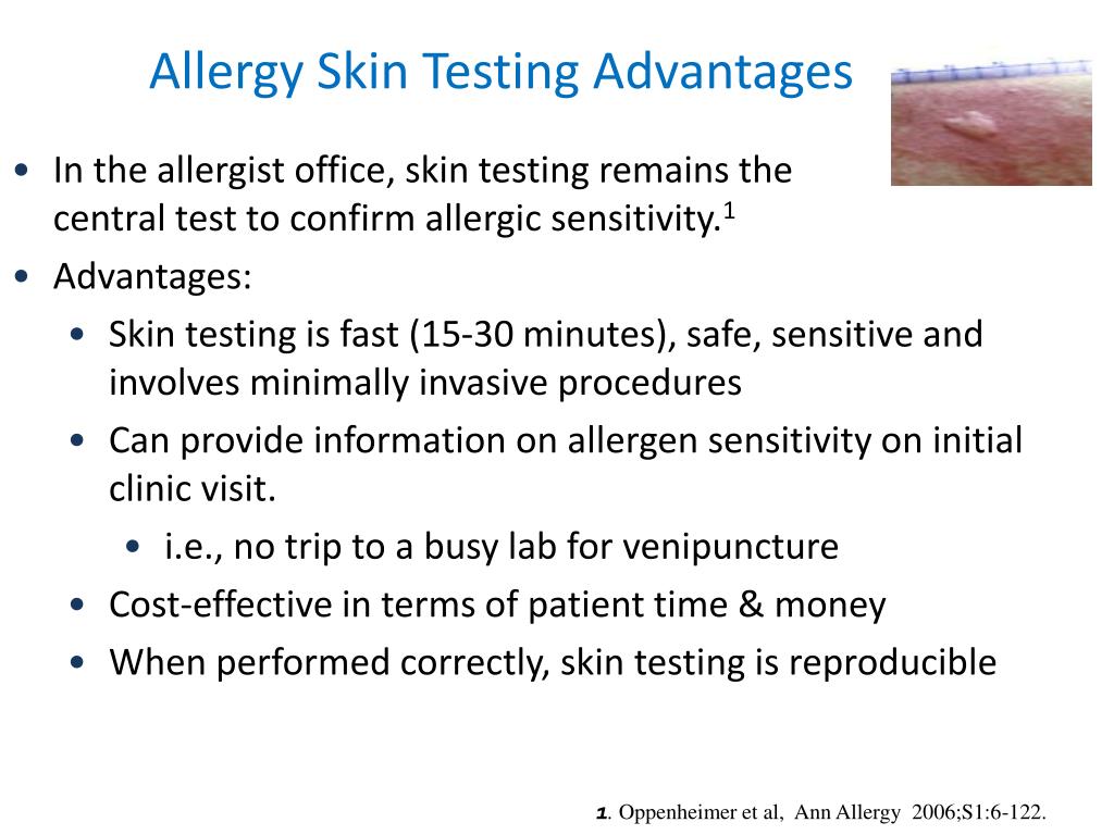 PPT - Skin or In Vitro Test for Food Allergy? Skin Test PowerPoint ...