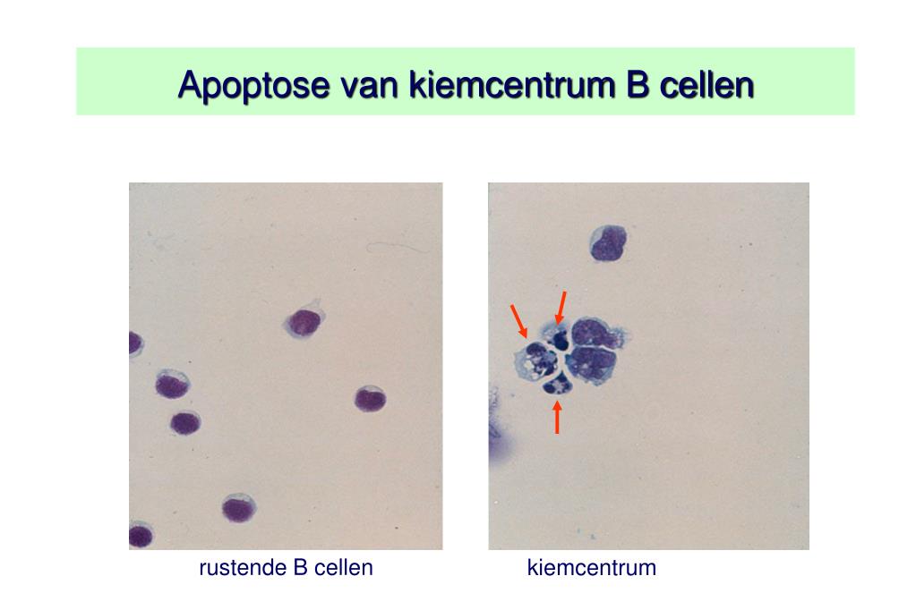 PPT - Folliculair non-Hodgkin Lymfoom Blok oncologie, April 2012 ...