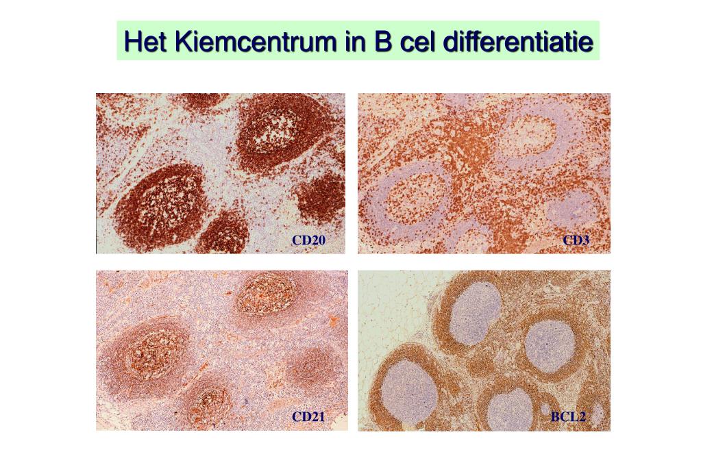 PPT - Folliculair non-Hodgkin Lymfoom Blok oncologie, April 2012 ...