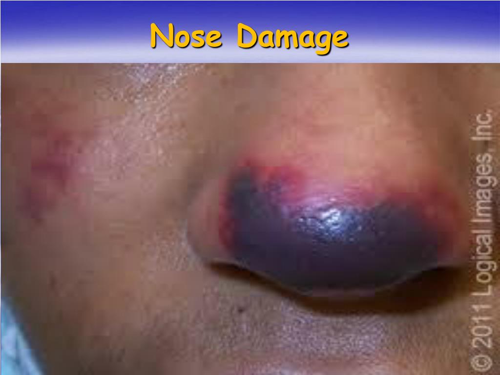 PPT - Drugs and the work place awareness Signs and Symptoms Ron Flowers ...