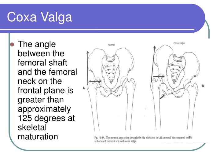 PPT - Evaluation of the Hip & Thigh PowerPoint Presentation - ID:3329736